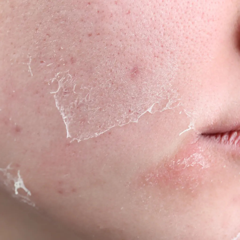 Dry Skin Collection | Deep Hydration Skincare by Bubblez – Bubblez ...
